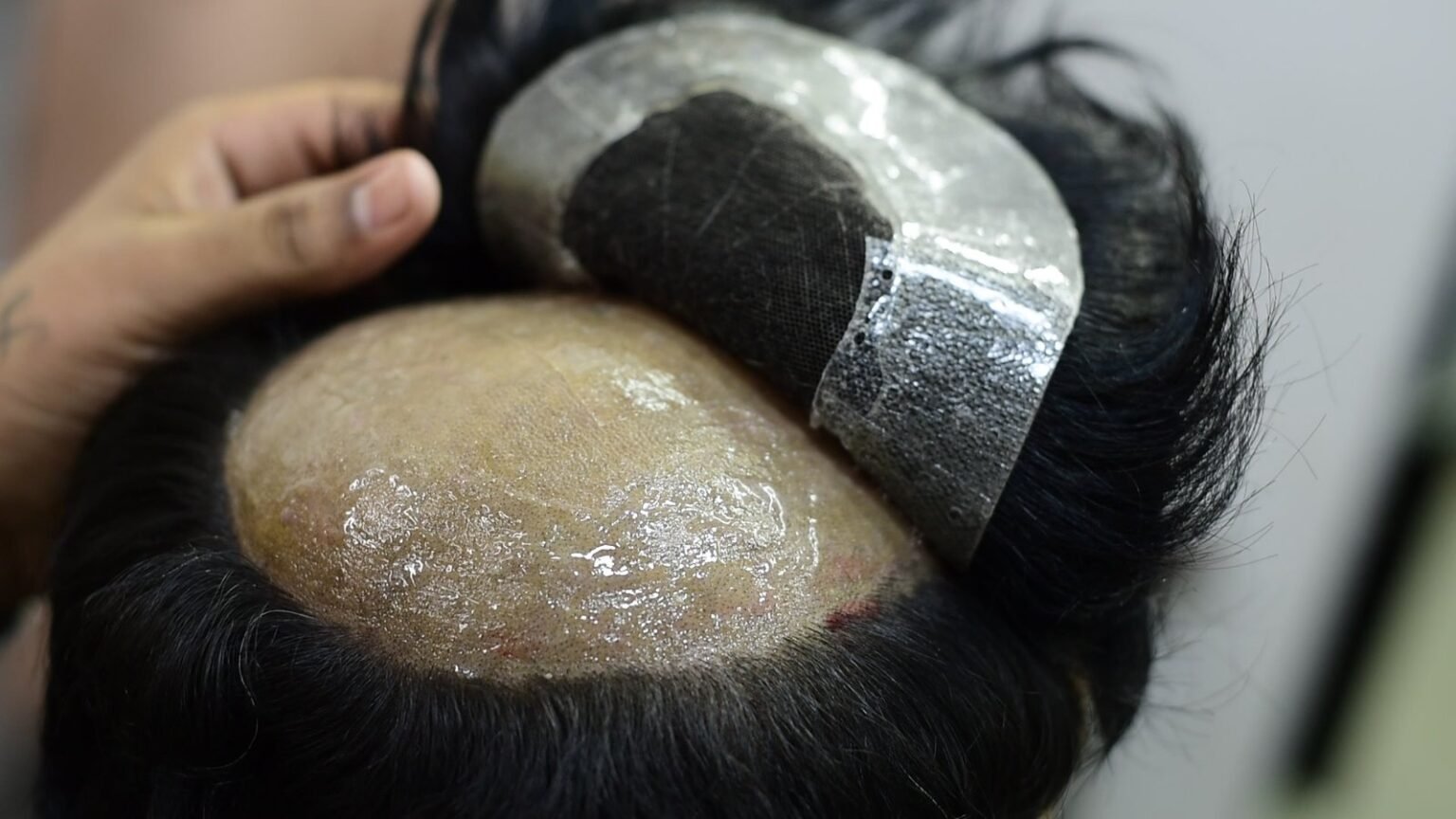 Clip on Hair Systems for Men | Non-Surgical Hair Replacement