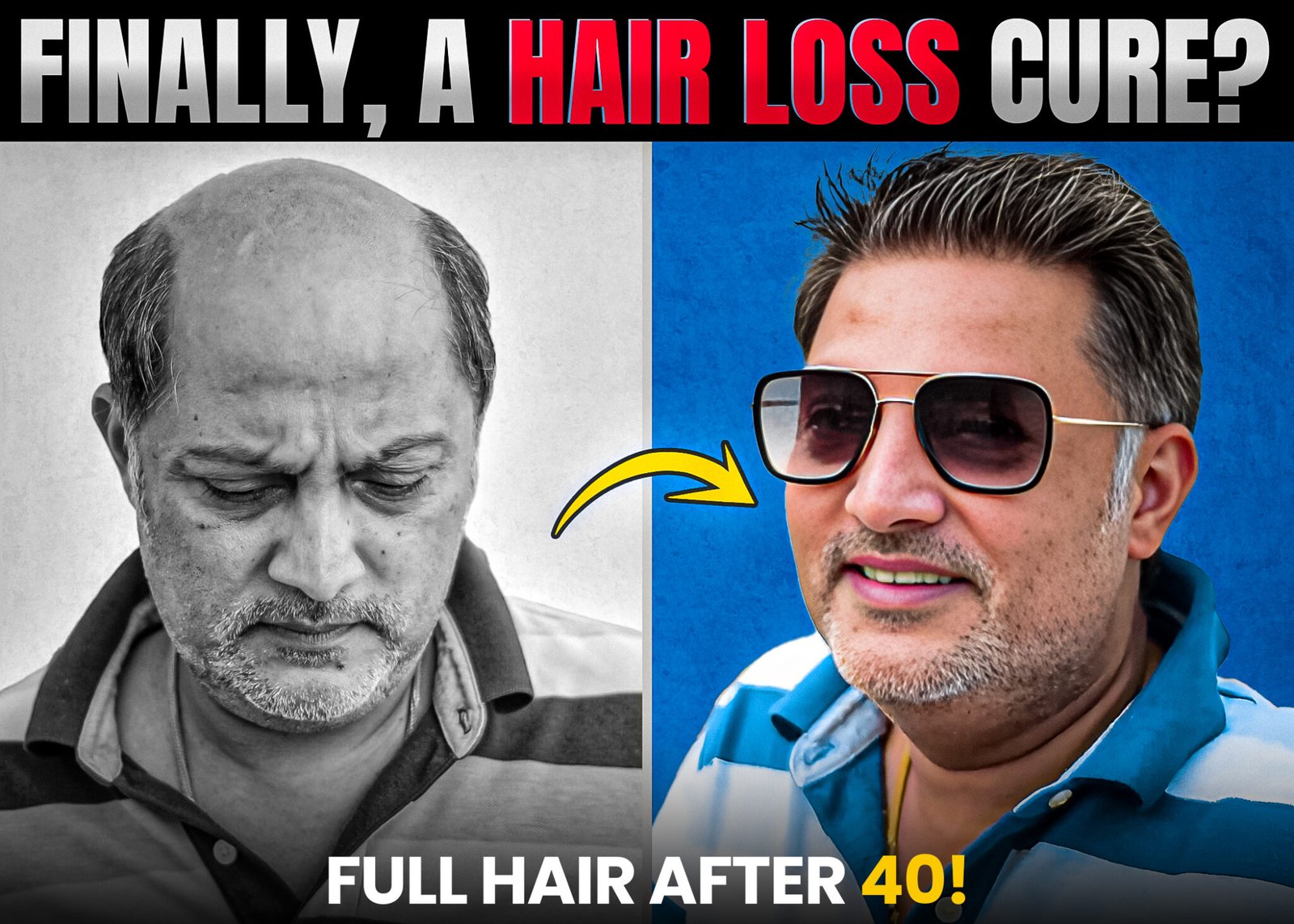 How Indian Men in Their 40s Are Fighting Hair Loss Successfully ...